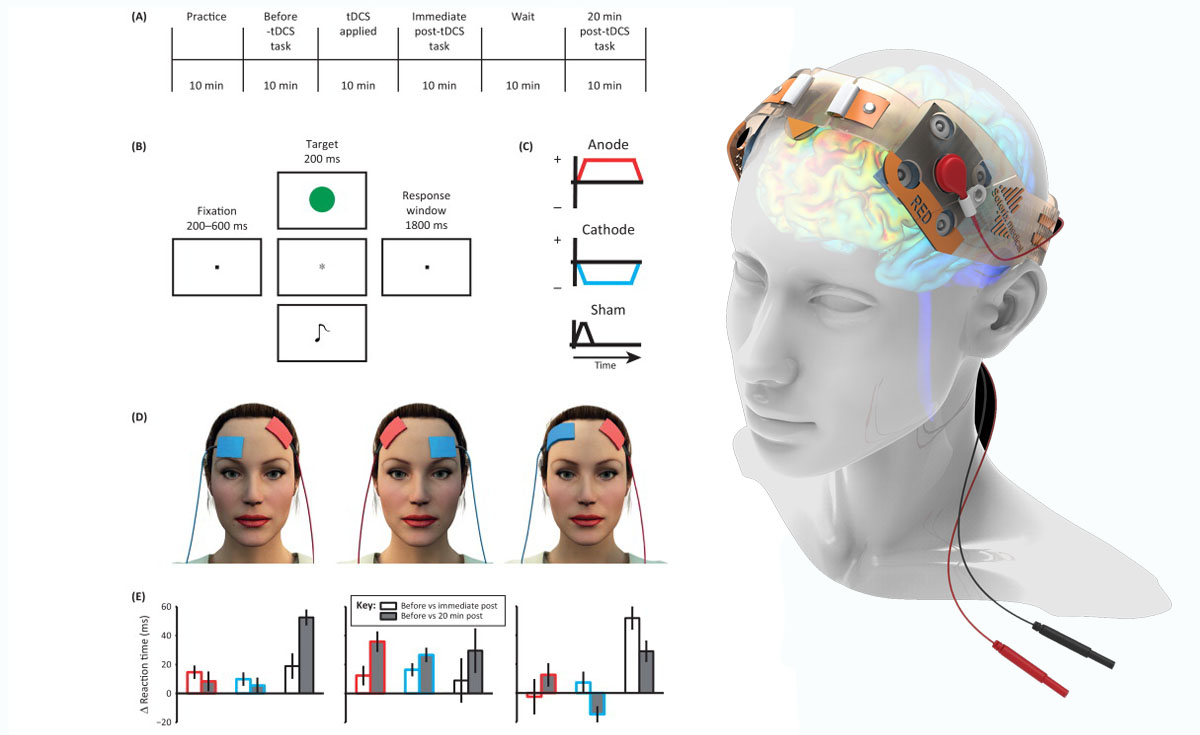 tDCS-Transcranial Direct Current Stimulation; affected by Depression ...